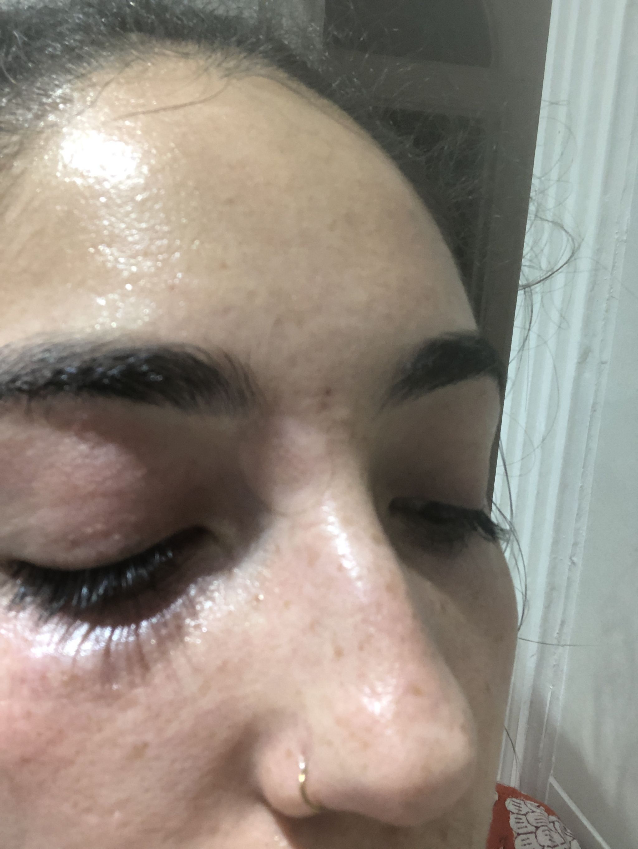 Is ZitSticka the answer to cystic spots? • Beauty and travel from ...